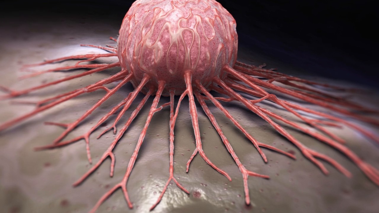 What Is Breast Cancer ILiveWell what-is-breast-cancer-ilivewell